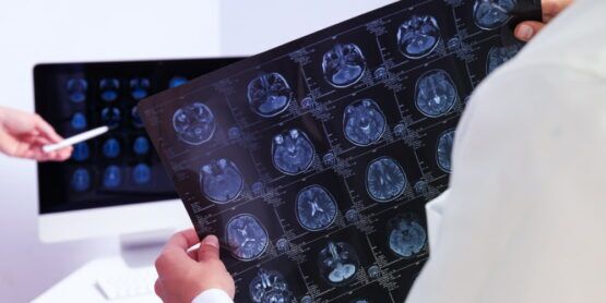 Top 10 Muscle Diseases List: Symptoms & Treatments